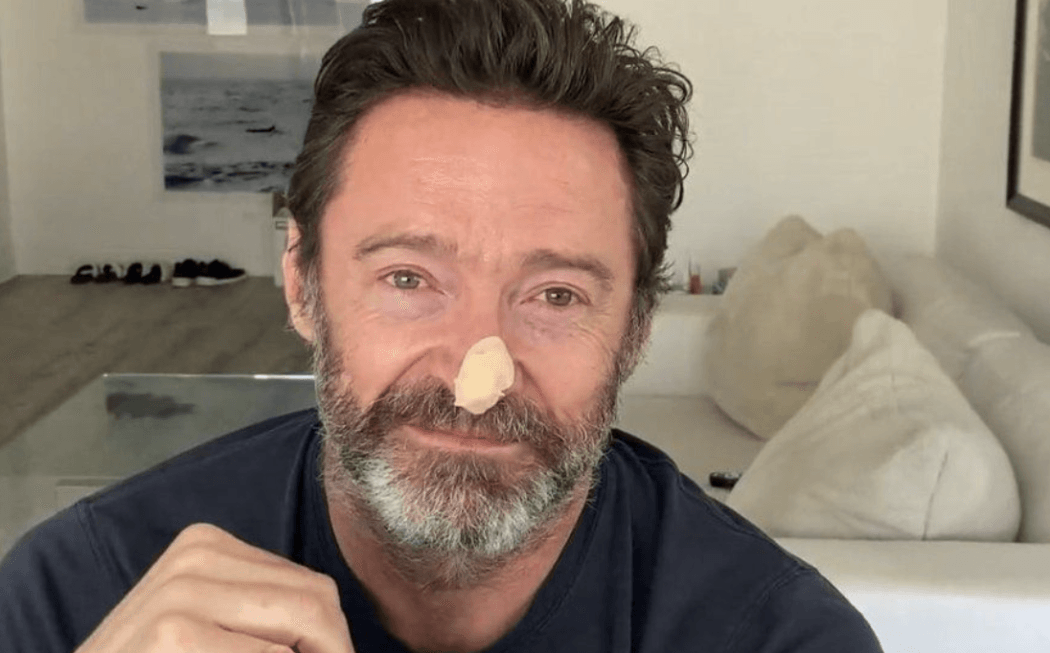 What Hugh Jackman Wants You To Know About Skin Cancer Genesis Dermatology